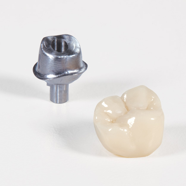 Dental Implant Restorations - Titan Surgical Systems Full Arch Dental ...